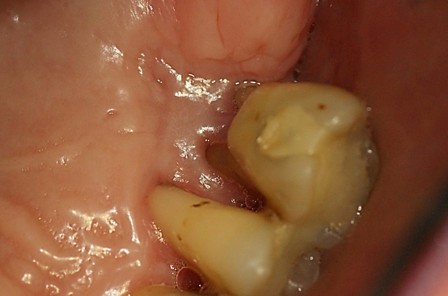 PerioClinic - Periodontia Especializada e Implantodontia: Tratamento ...