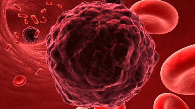 ¿Sabías que los términos "canceroso" y "cancerígeno" no son sinónimos?