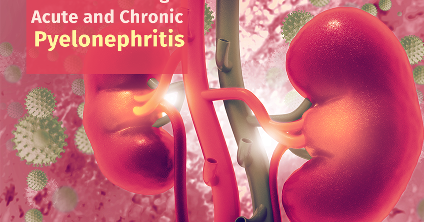 Natural kidney disease treatment : Understanding Acute and Chronic ...