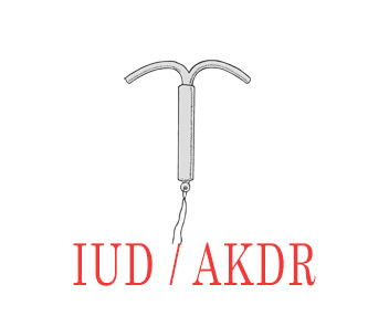Kelebihan dan Efek Samping dari IUD / AKDR - Magazine Blog