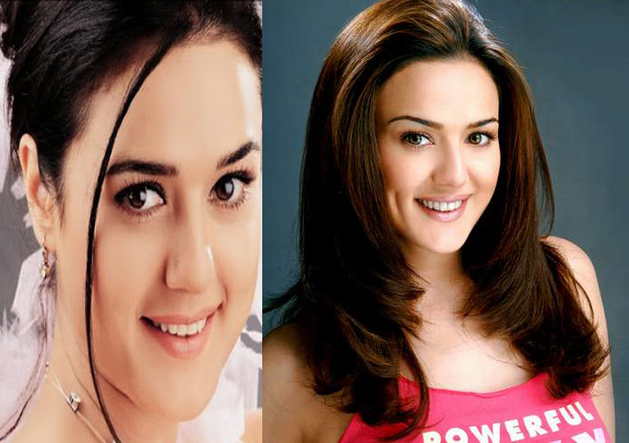 Preity Zinta Plastic Surgery