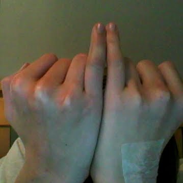 Picture Perfect: :( Sprained pinky