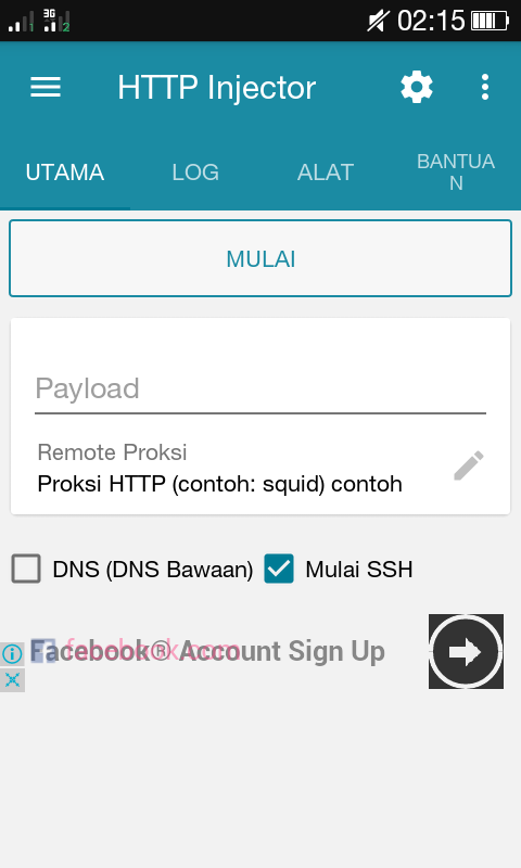 Cara Membuat Config Injector Axis dan XL Terbaru 2017 [WORK!!!] | RURiViN