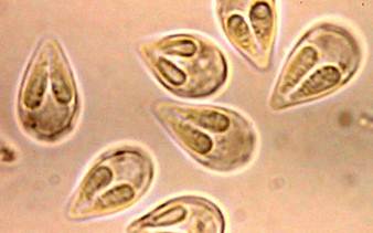 Microbiologia y Parasitologia 2_E Unpa: Myxobolus sp