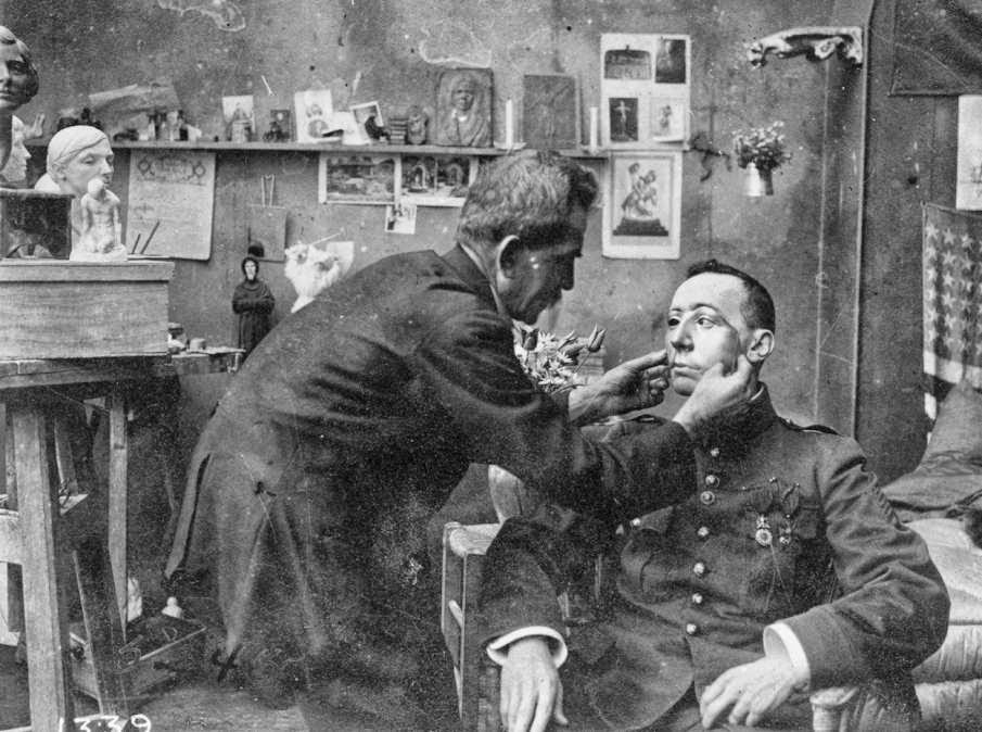90 Miles From Tyranny : French soldier whose face was mutilated in ...