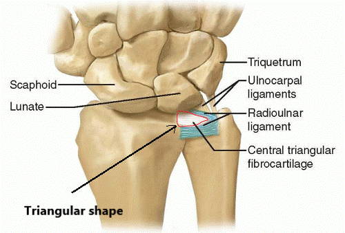 TFCC (Triangular Fibrocartilage complex) tear: Triangular Fibrocartilage complex (TFCC)