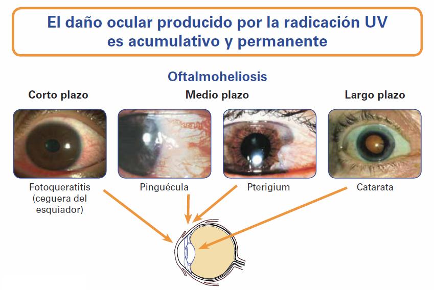 Leyendo y Comprendiendo: Los Rayos Ultravioleta