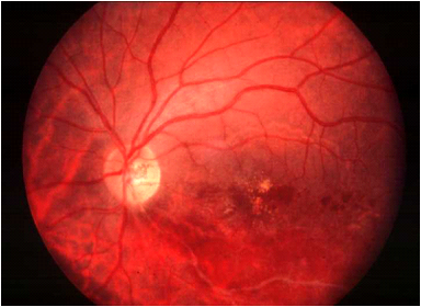 Dentistry and Medicine: Behçet’s disease-Short note