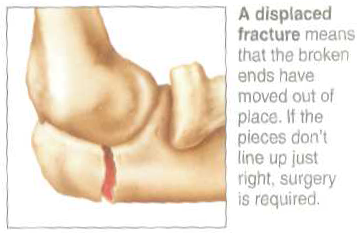 planbike: The Bicycle Safety Within: Watchout For Spokes