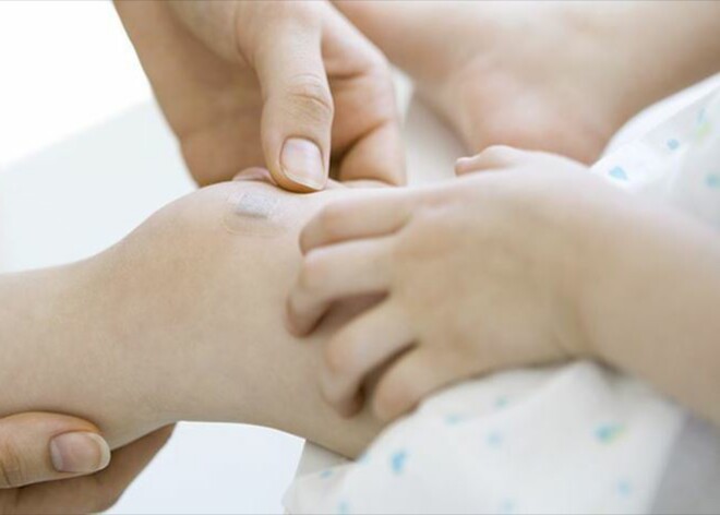 Tips Menangani Luka Pada Anak — Heni Puspita