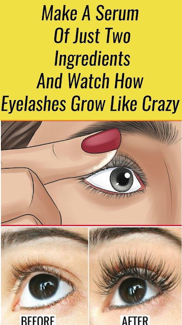 Make A Serum Of Just Two Ingredients And Watch How Eyelashes Grow Like ...