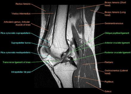 ABC Radiology Blog: Knee Joint