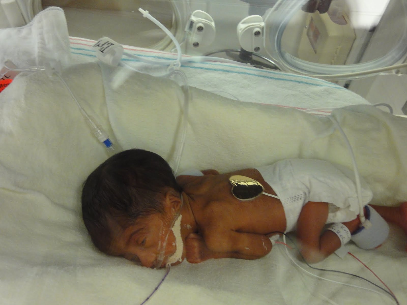 Kenadie Camille: Kenadie's Story