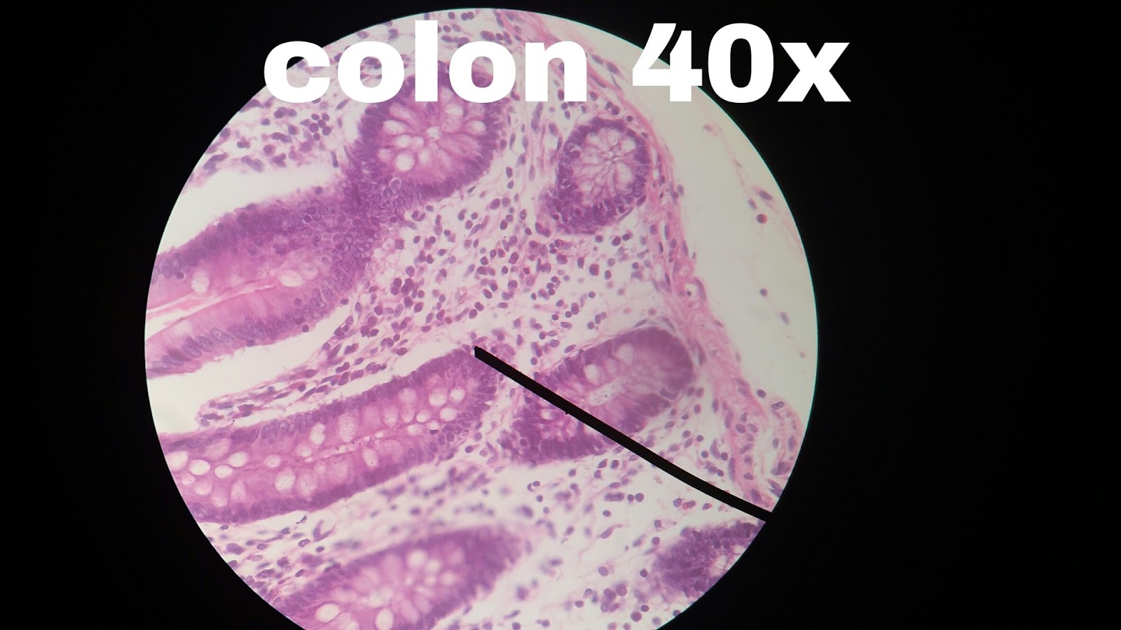 THEONEDESTINY: Colon Histology