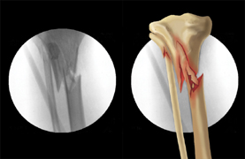 Fracture/Dislocation/Sublaxation ~ Anatomy for MSP