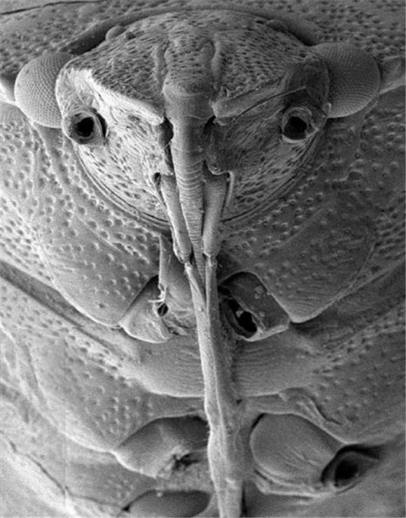 Once upon the Rainy Day: Life Under The Electron Microscope