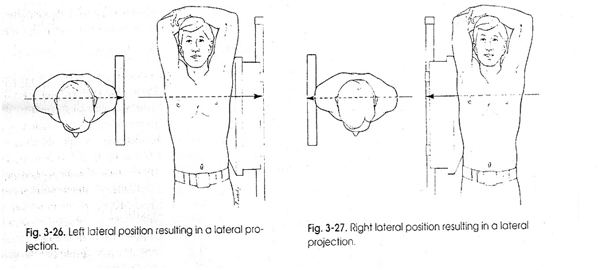 TEKNIK RADIOGRAFI DASAR - RADIOLOGI SCIENCES