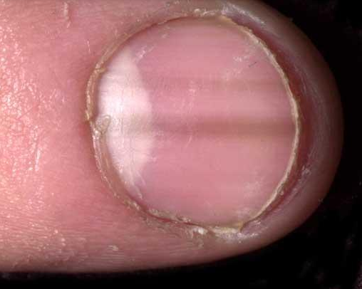 Nails and you ~ INFOSCOUT