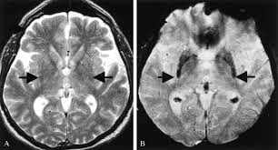 Medical Treatment Pictures-for Better Understanding: Multiple System ...