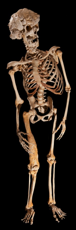 Joseph Carey Merrick:el hombre elefante | Historias increibles