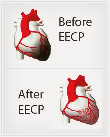 Non Invasive Heart Care