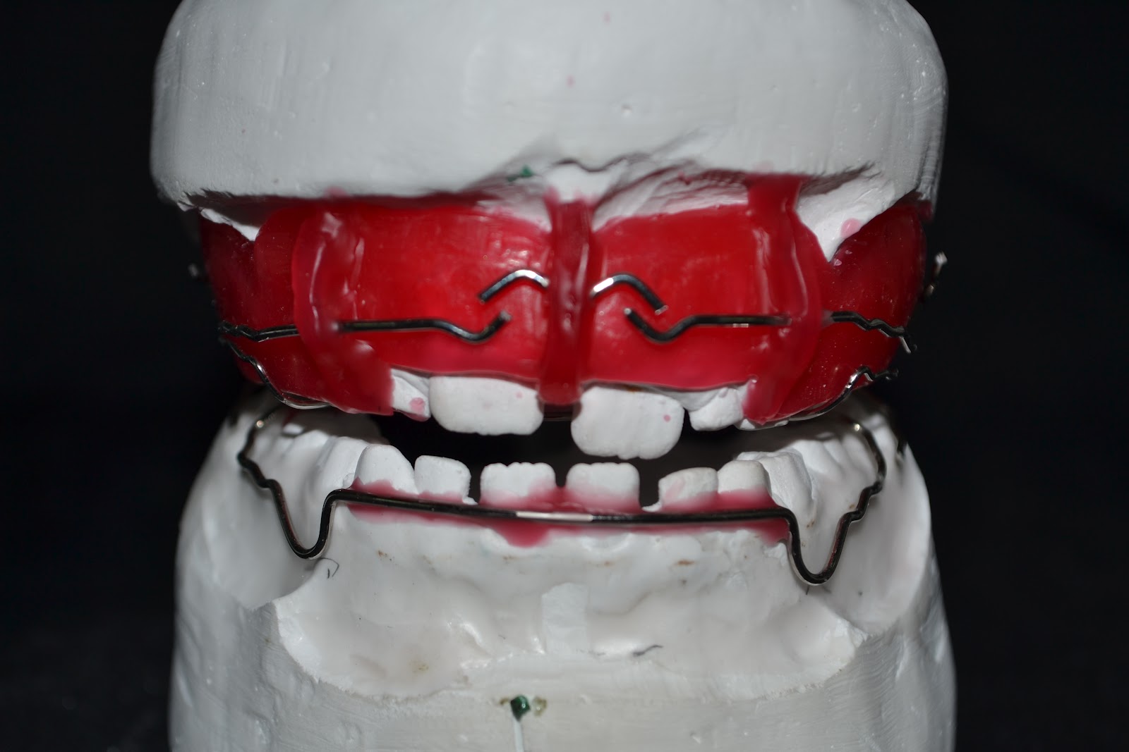 Laboratorio Ortodontico MRdental: FRANKEL 3