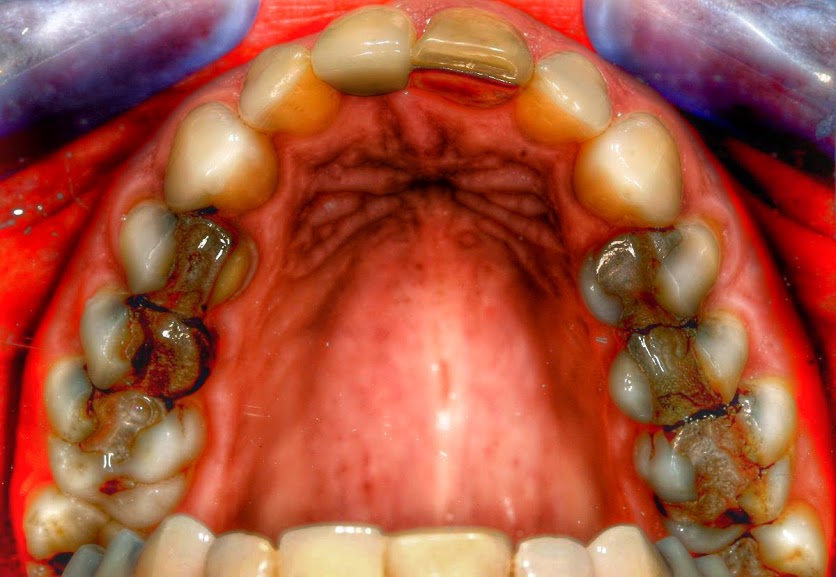 AMÁLGAMA: Composição - Videoconferência do Prof. Gustavo Rivera