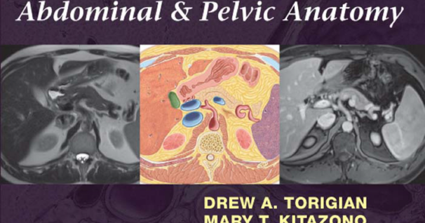 Netter's Correlative Imaging - Abdominal and Pelvic Anatomy 1st Edition ...