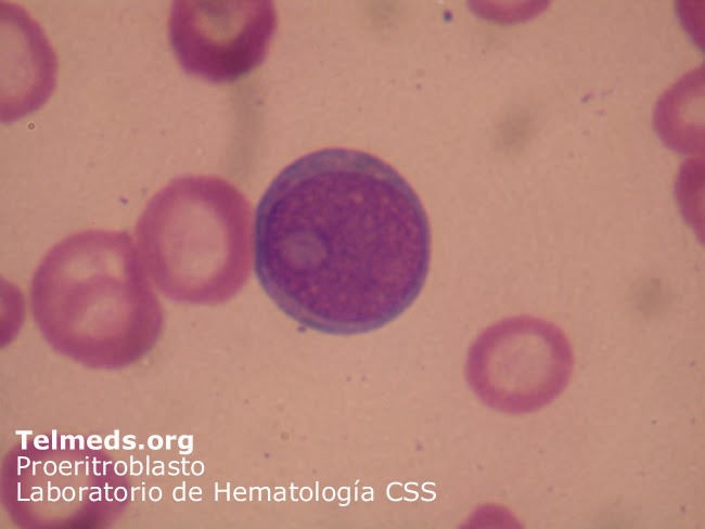 Fichero de Hematología Heber Mayén: Proeritroblasto