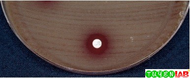 [Microbiology] Atlas of Antimicrobial Susceptibility Testing | Free ...