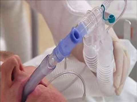 O papel do fisioterapeuta no procedimento de intubação ~ Fisionerds