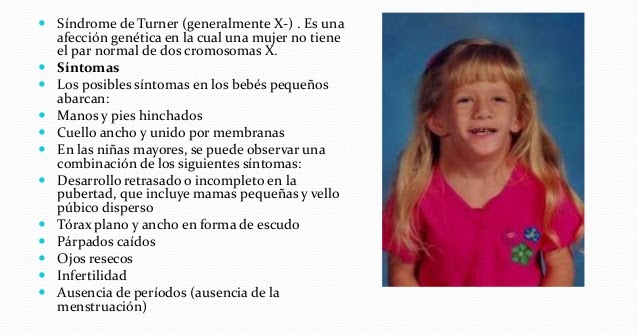 Embriología: VARIACIONES CROMOSÓMICAS NUMÉRICAS