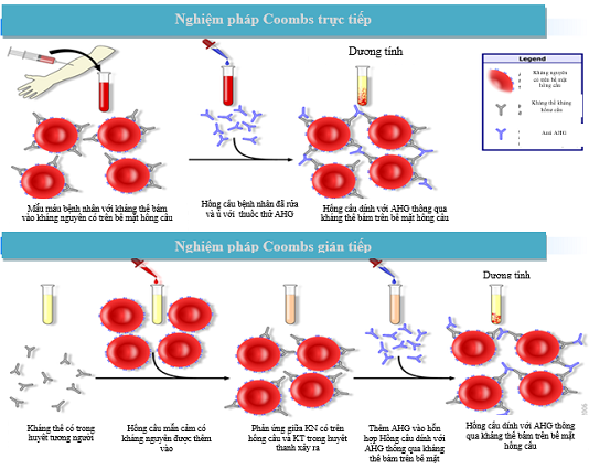 Nghiệm pháp Coombs (Coombs test) | Diễn đàn Y Dược Trà Vinh