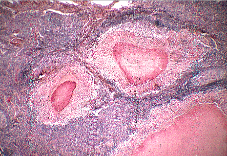 EL RINCÓN DE LA MEDICINA INTERNA. juanpedromacaluso@yahoo.com.ar: SIGNO ...