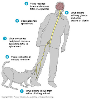 symptoms of rabies in human