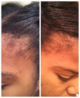LeLee's Healthy Hair Journey: Ahhhh!! My Edges Are Messed Up Again