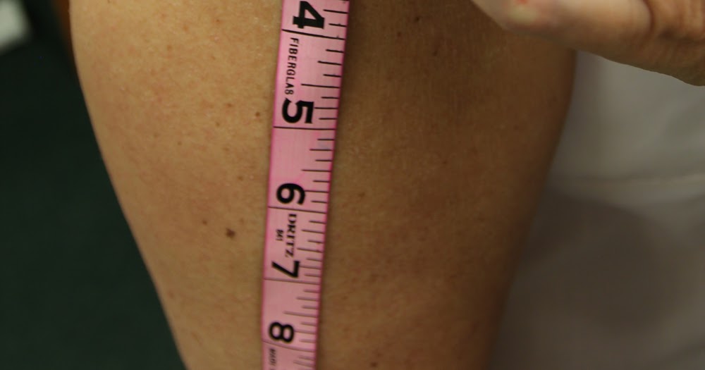 Sure-Fit Designs™ Blog: Forward Thrusted Shoulder