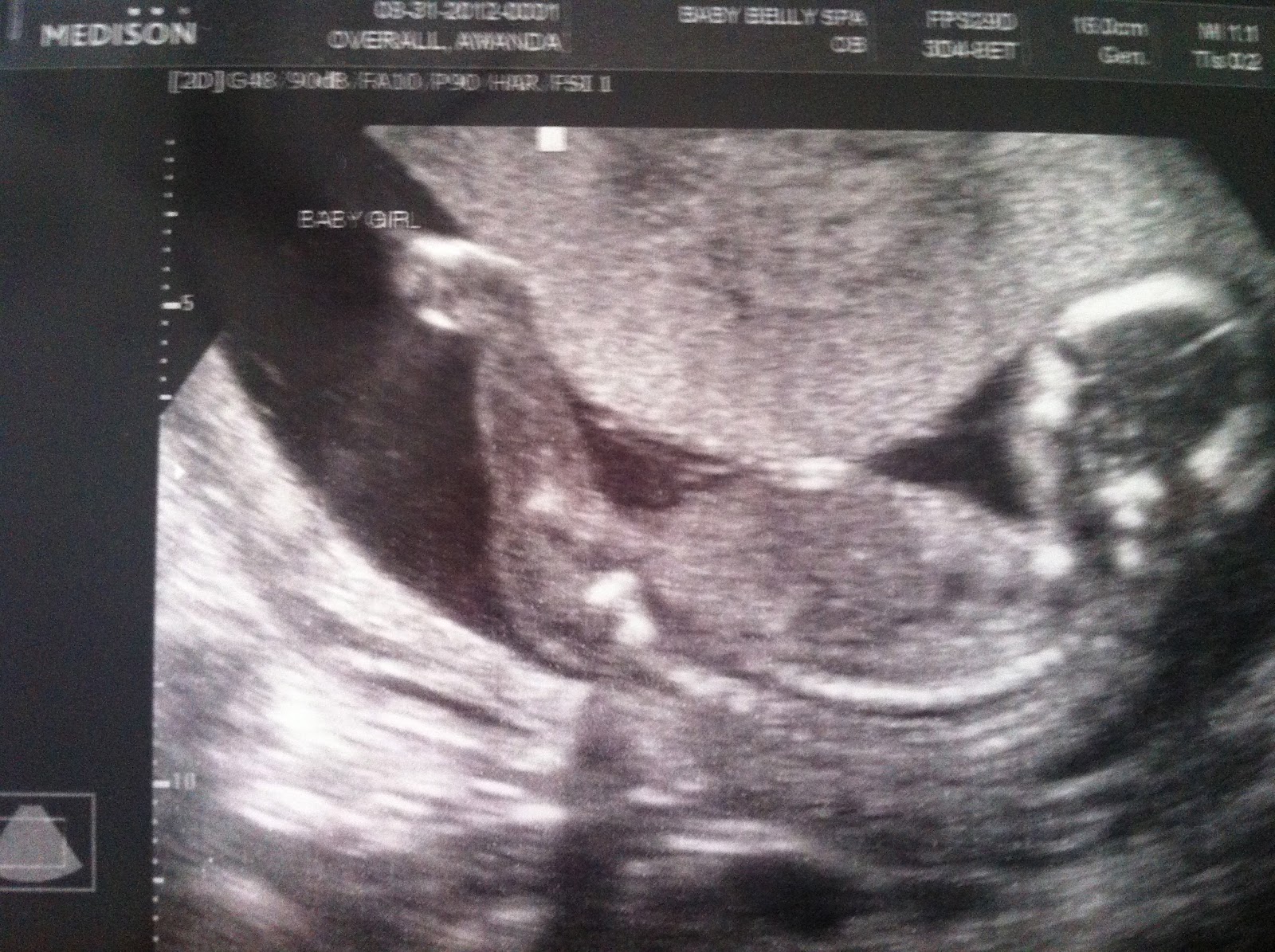 Triple Braided Cord: Gender Reveal