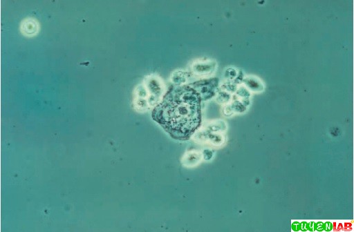 [Microbiology] Atlas of Genital Infections and Sexually Transmitted ...