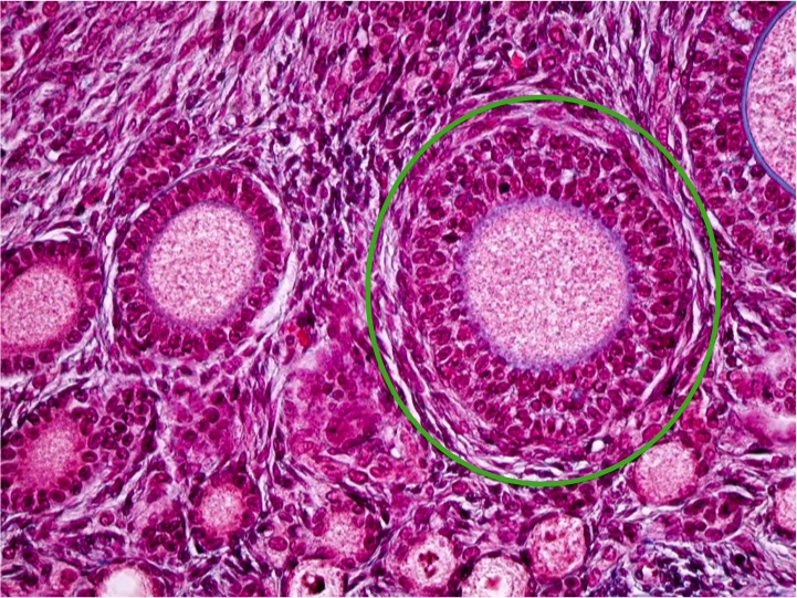 SOS BIOLOGIA CELULAR Y TISULAR: GENITAL FEMENINO. OVARIO