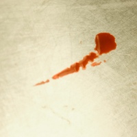 Good Article Health: Hematidrosis the Sweat Blood Diseases