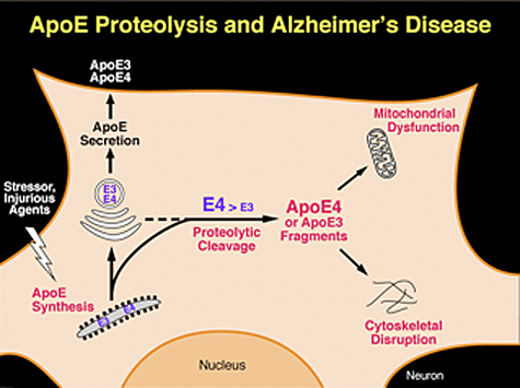 MedicineNet: Alzheimer's Disease