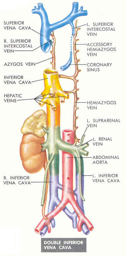 Pedi cardiology: Anomalies of Inferior Vena Cava