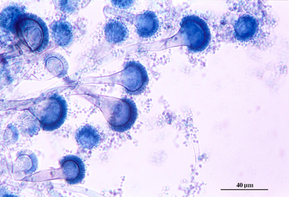 MBBS Medicine (Humanity First): Microscopic morphology of Aspergillus
