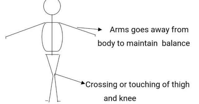 scissoring gait physiotherapy management - PHYSIO STUDY