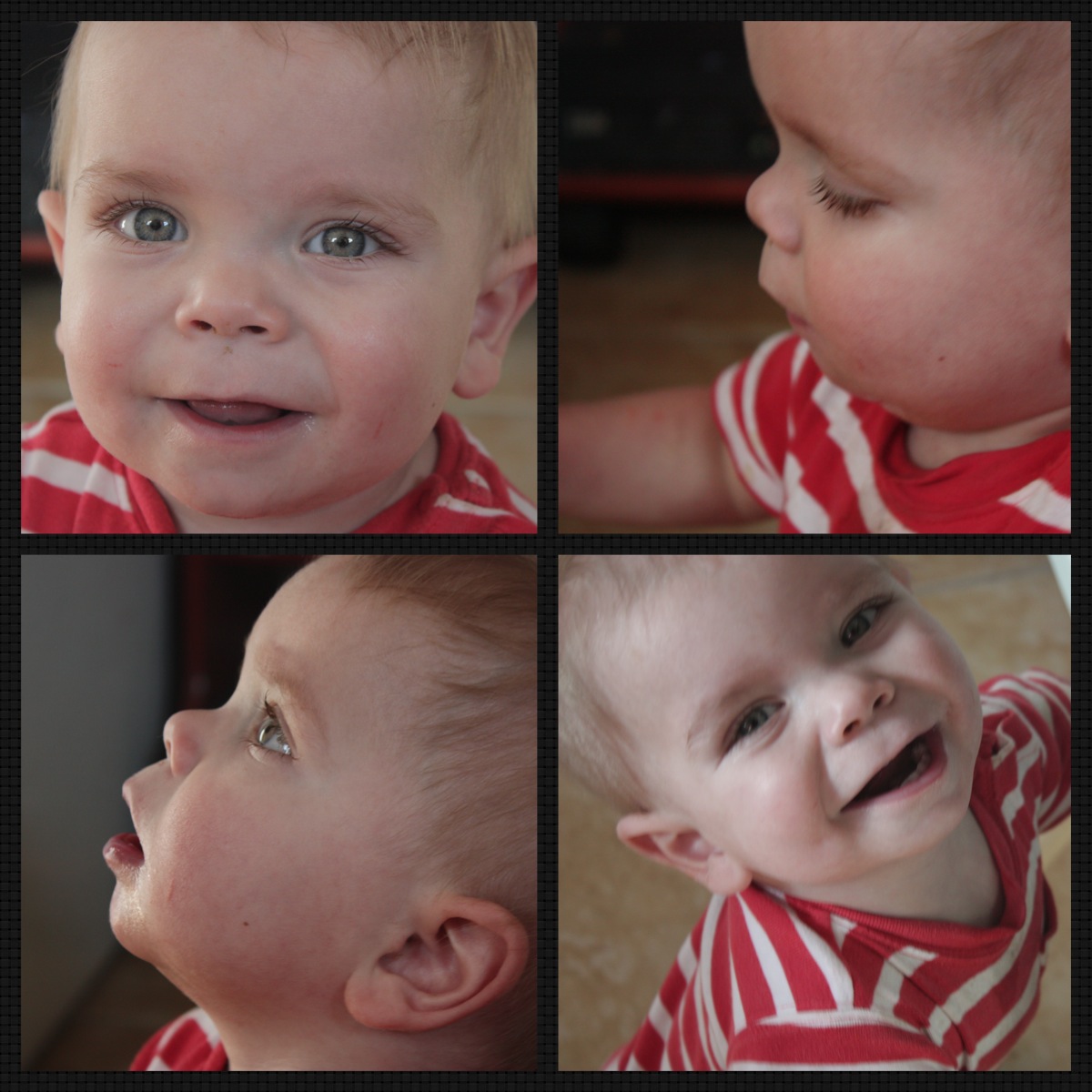 Our HLHS spunky monkey Xander