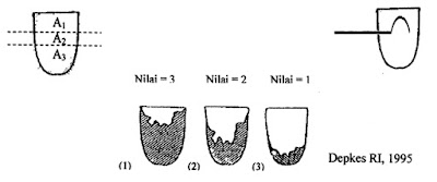 Skripsi Kesehatan Gigi dan Mulut