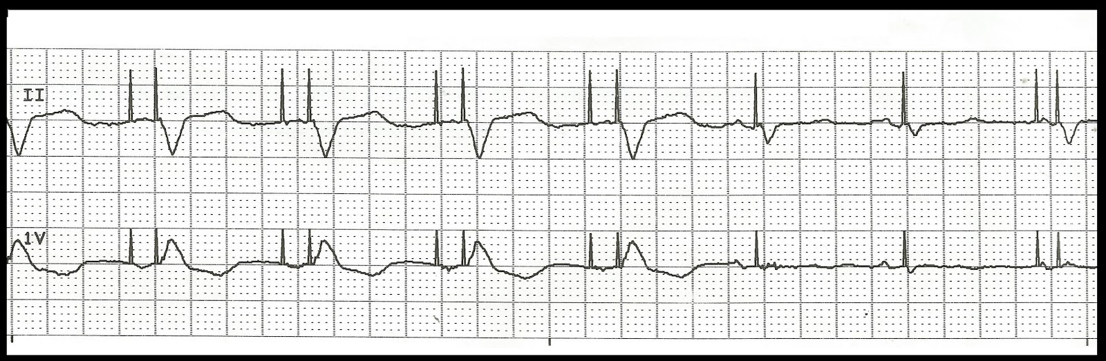 EKG Rhythm Strip Quiz 126