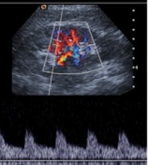 Medical Instrumentation: EchoKardio (Cardiac Echo)