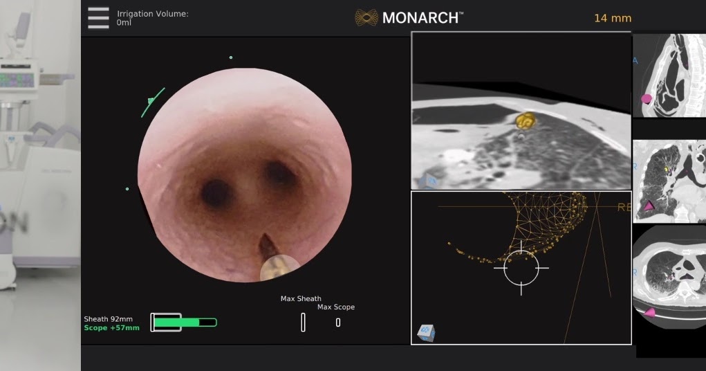 Auris' Monrach unveiled